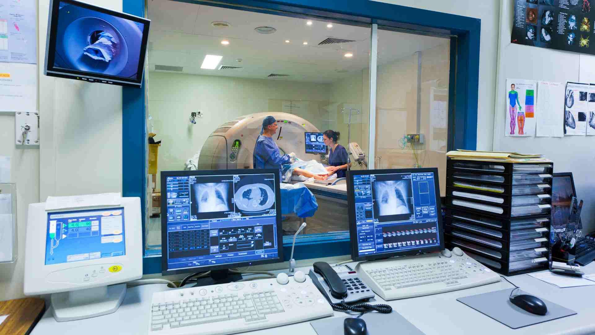 NHS to launch AI screening trials with new cloud platform